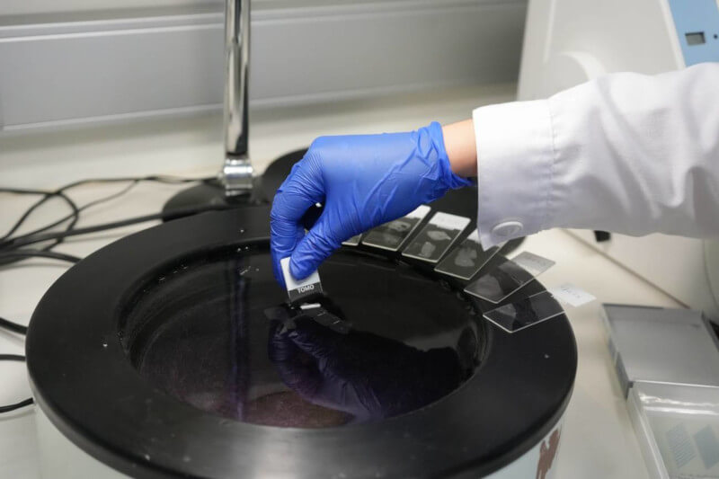 La córnea artificial desarrollada en Granada finaliza con éxito su ...